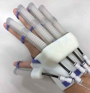 Researchers Studying Wearable Technology for Stroke Patients